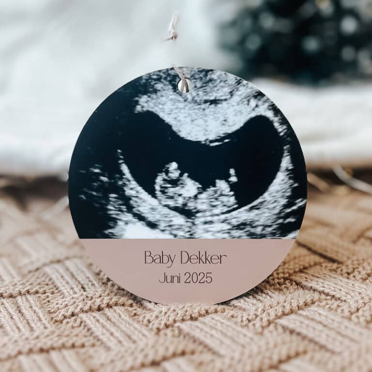 Kerstbal | Echo foto - Hip&Mama Box